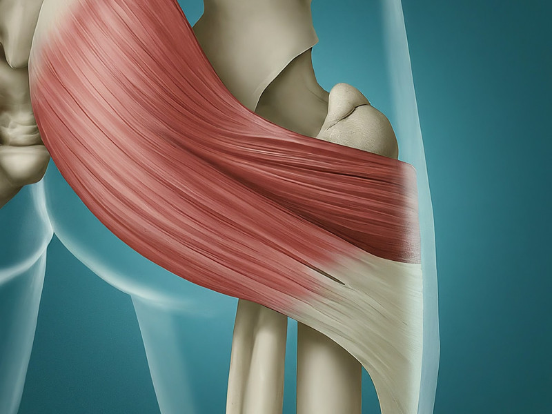 Tensor Fasciae Latae Strain: Symptoms, Diagnosis, and TFL Strain Tests ...