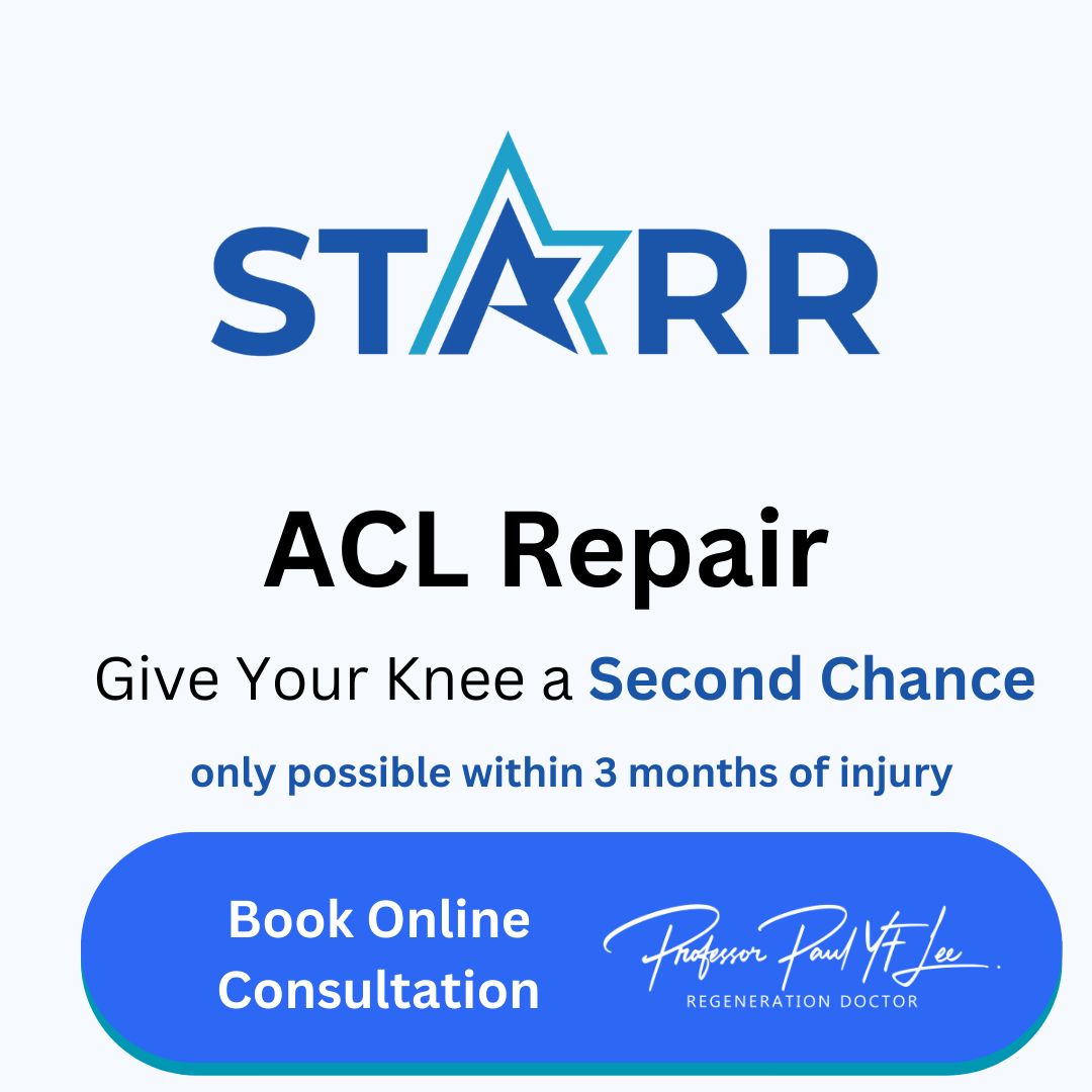 Understanding The ACL Surgery Recovery Timeline For Optimal Results Understanding The ACL Surgery Recovery Timeline For Optimal Results